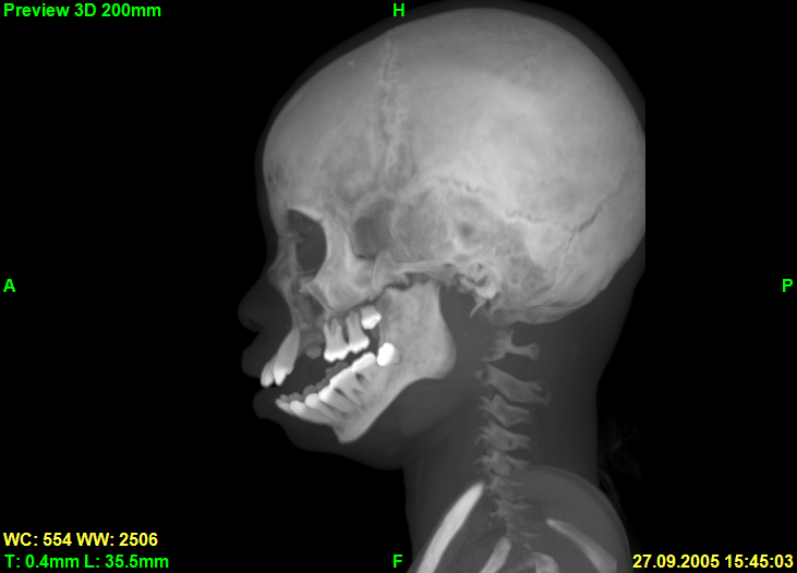 Dicom Multiplanar Reconstruction